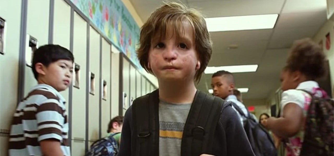 Wonder/ Film drammatico su Rai 1, oggi 19 aprile